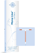 Copper IUD as a Contraceptive : Contraception with Mona Lisa